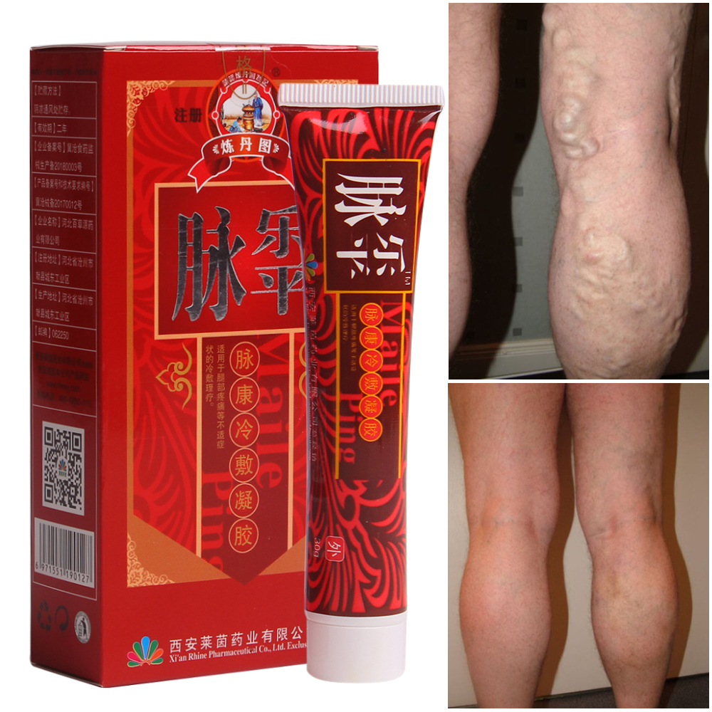 Jual KRIM SALEP PENGHILANG VARISES KAKI VARICOSE VEINS OINTMENTS ...