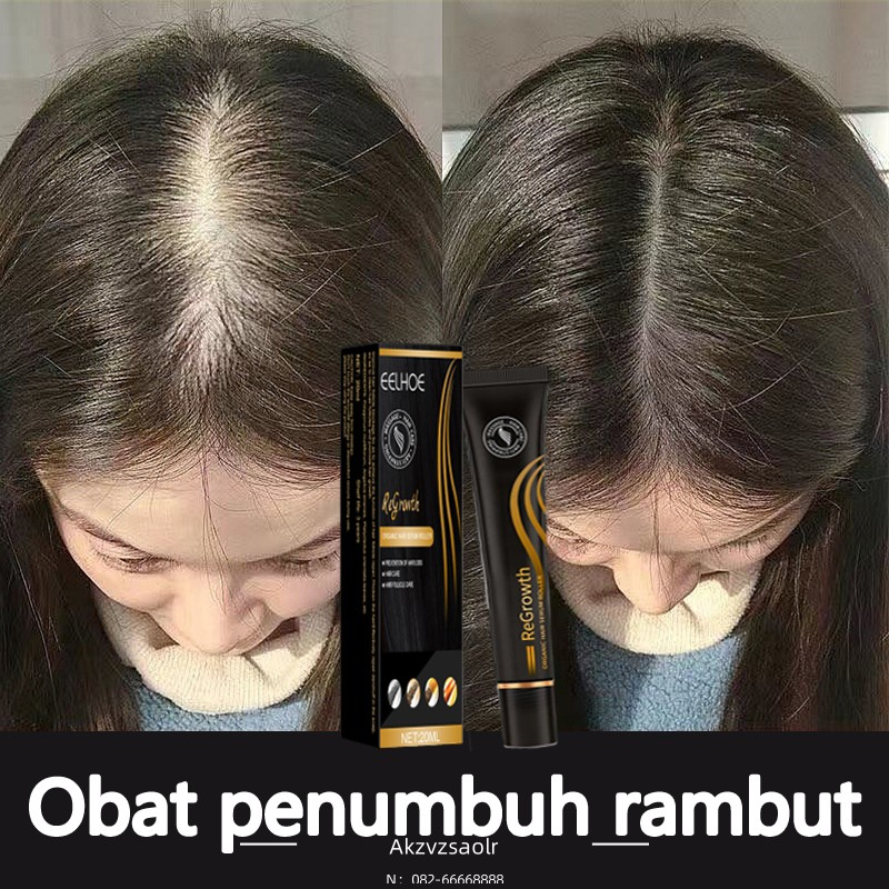 Jual Penumbuh rambut Penumbuh rambut botak Serum penumbuh rambut Hair ...