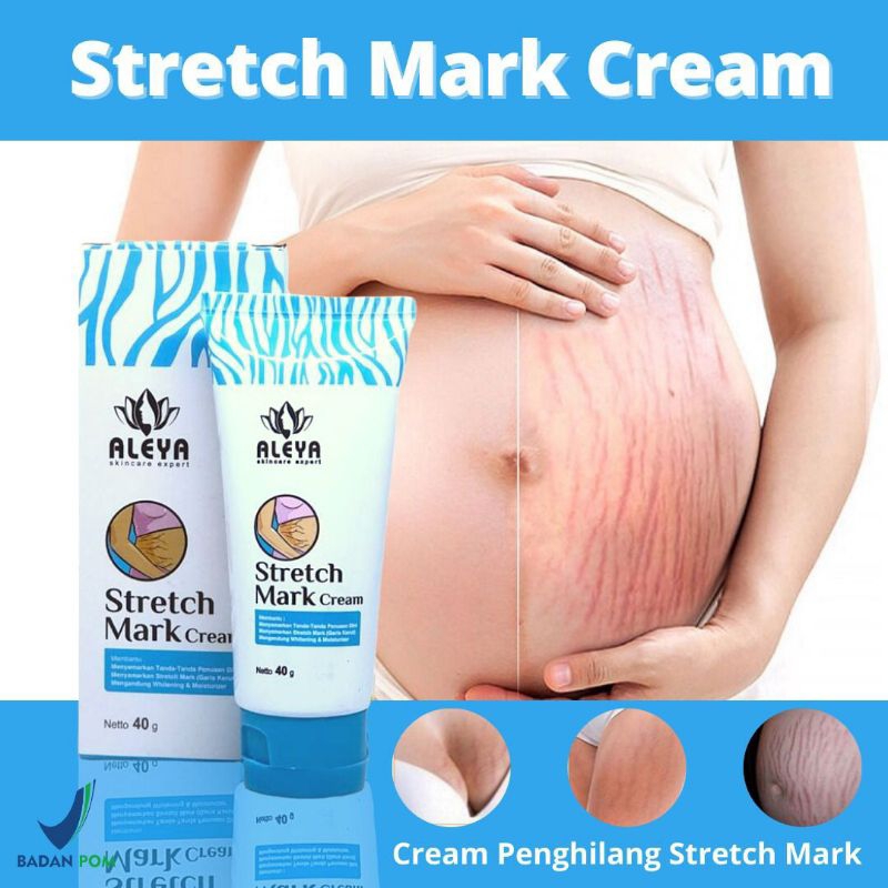 Jual Cream Strecth Mark Penghilang Strechmark Penghilang Bekas Luka ...