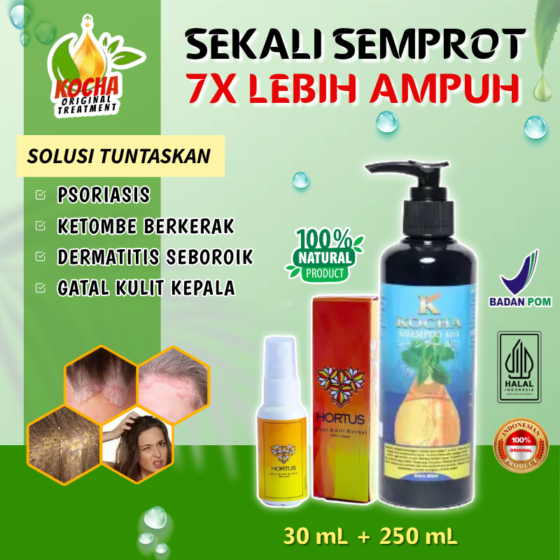Jual Hortus Obat Psoriasis Gatal Kulit Kepala Kocha Shampoo Anti Ketombe Berkerak Kering Rambut ...
