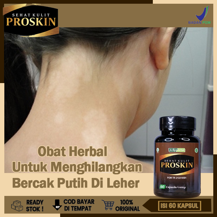 Jual Obat Bercak Putih di Leher, Obat Untuk Muncul Bercak Putih ...