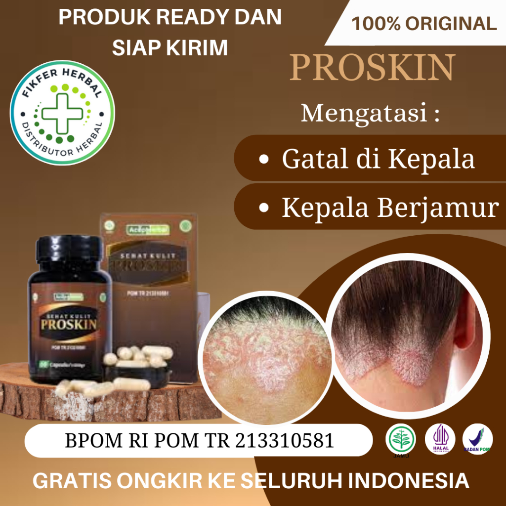 Jual Obat Gatal Di Kepala, Obat Koreng Di Kepala, Kepala Borok, Kepala Bersisik Tebal, Kulit ...