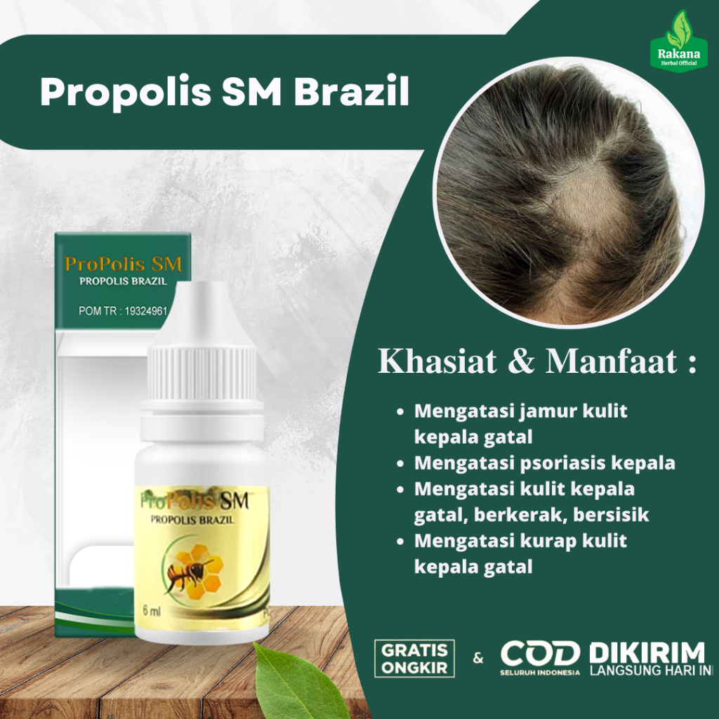 Jual Obat Jamur Kulit Kepala, Obat Tinea Capitis, Obat Dermatitis ...