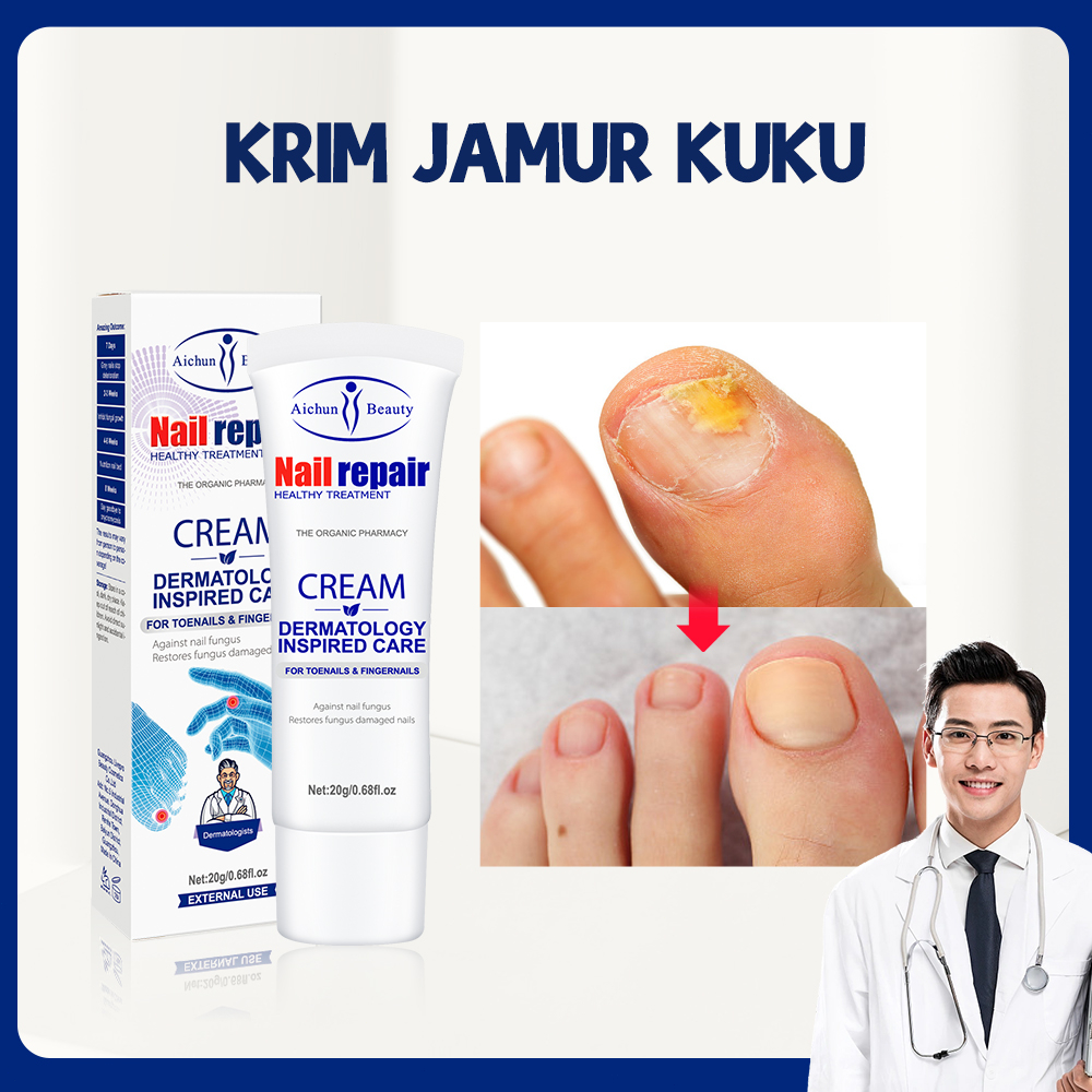 Jual 【beli 2 gratis 1】Aichun Obat Jamur Kuku Anti Jamur Perawatan Kuku ...