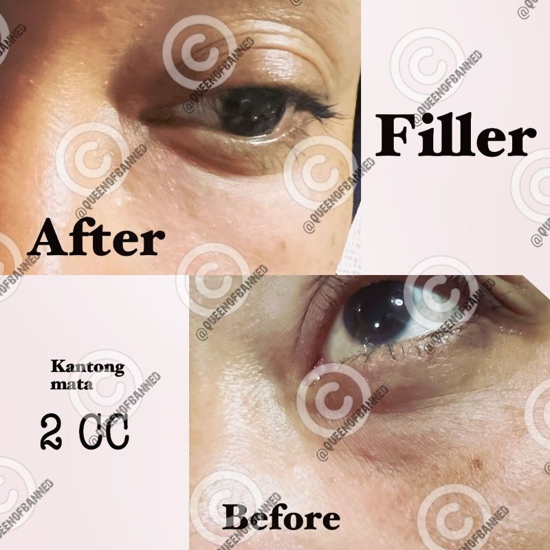 Jual ukuran 2cc/ml | Shopee Indonesia