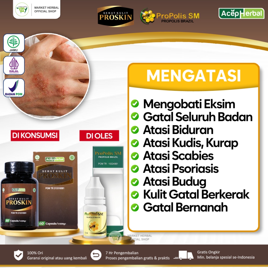 Jual Obat Eksim Kering Basah Kurap Kudis Scabies Cacar Psoriasis Budug ...