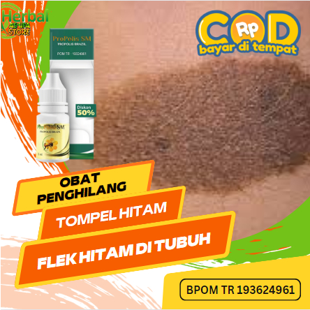 Jual Obat penghilang tompel hitam, penghilang tompel hidup di wajah ...