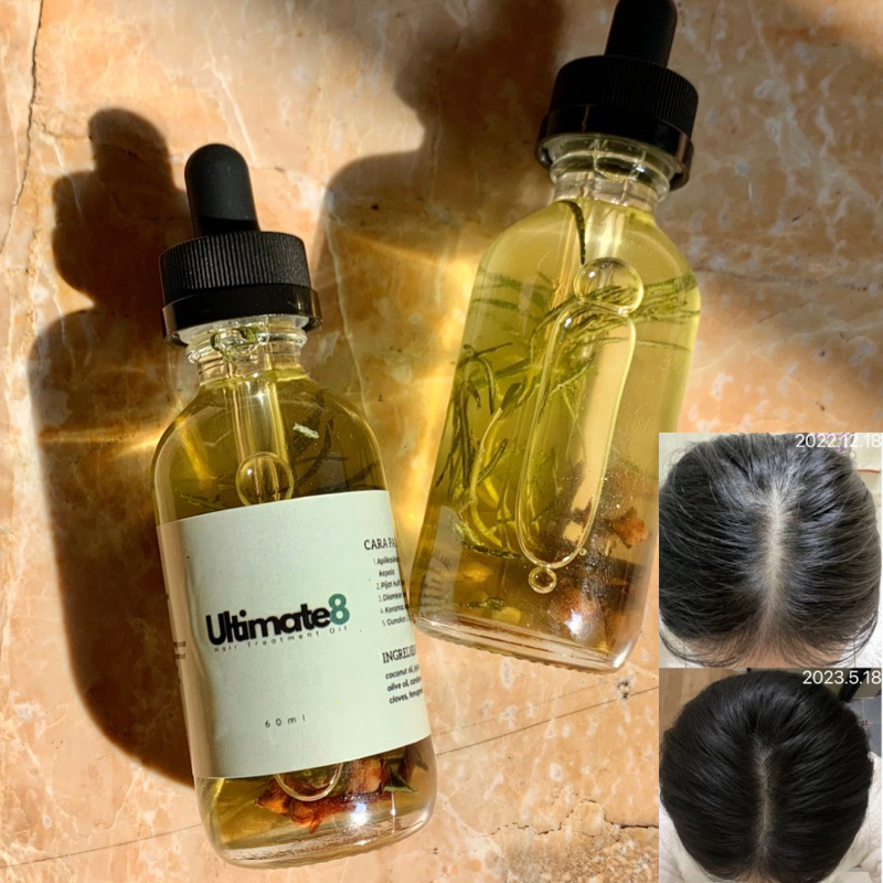 Jual ULTIMATE8 HAIR TREATMENT OIL | ROSEMARY HAIR OIL | HAIR OIL ARAB ...
