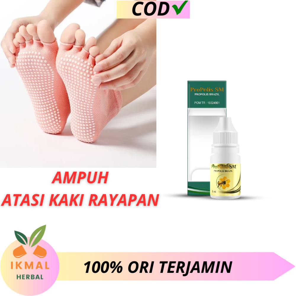 Jual Obat Kaki Rayapan, Obat Kaki Pecah Dan Kering Dengan Propolis SM ...