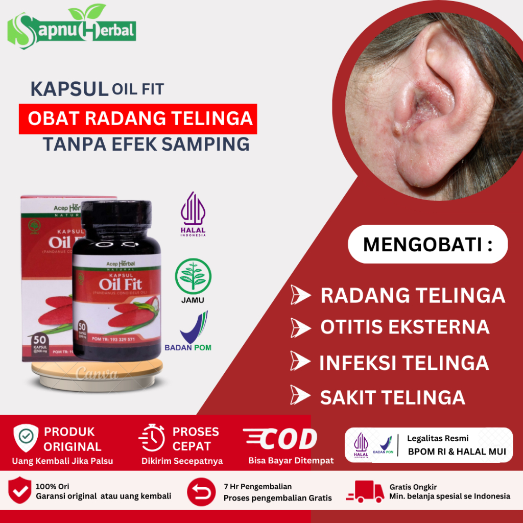 Jual Sapnu Herbal - Obat Radang Telinga Bagian Luar, Otitis Eksterna ...