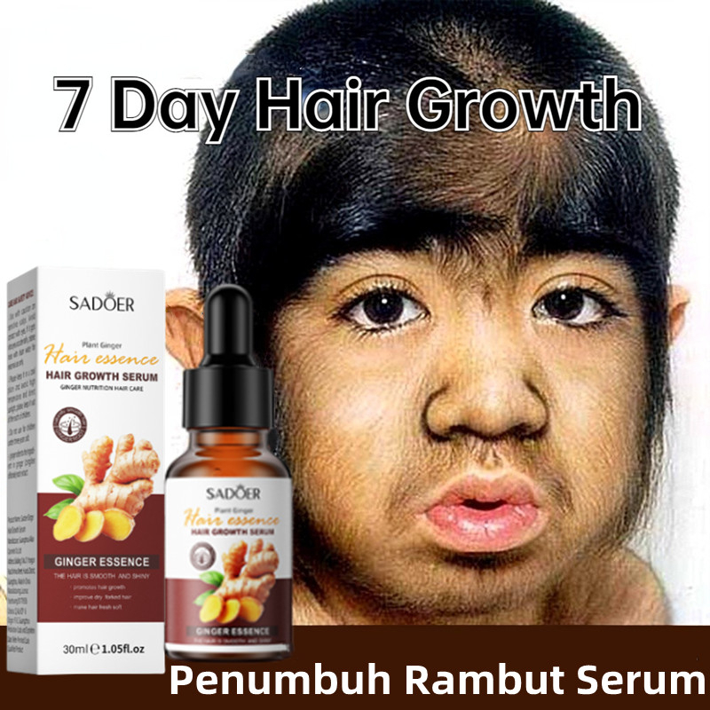 Jual Penumbuh Rambut Serum Rambut Rontok Perawatan Rambut Hair Growth ...