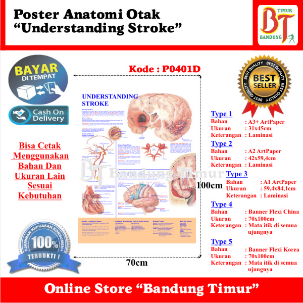 Jual POSTER ANATOMI OTAK - UNDERSTANDING STROKE | Shopee Indonesia