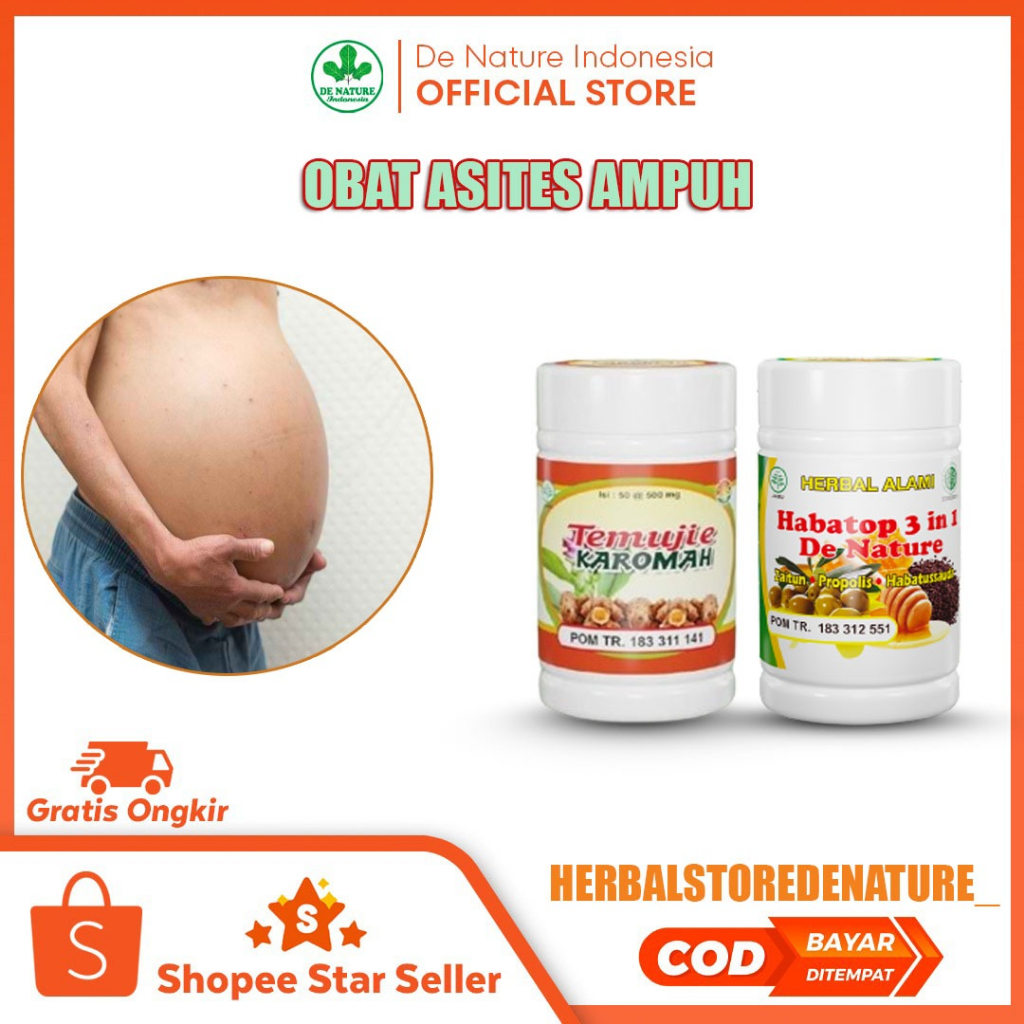 Jual Obat Asites Acsites Busung Air di perut Kelebihan Cairan Kembung ...