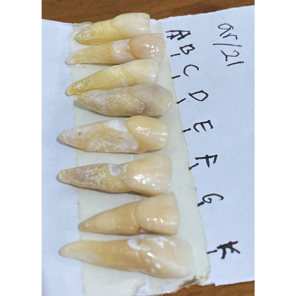 Jual GIGI INSISIVUS I1 21( GIGI PRAKTIKUM ) | Shopee Indonesia