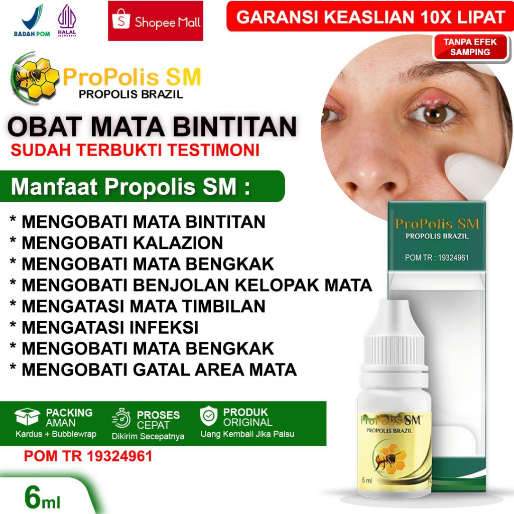 Jual Obat Mata Bintitan Mata Bengkak Mata Merah Obat Mata Kalazion Mata ...