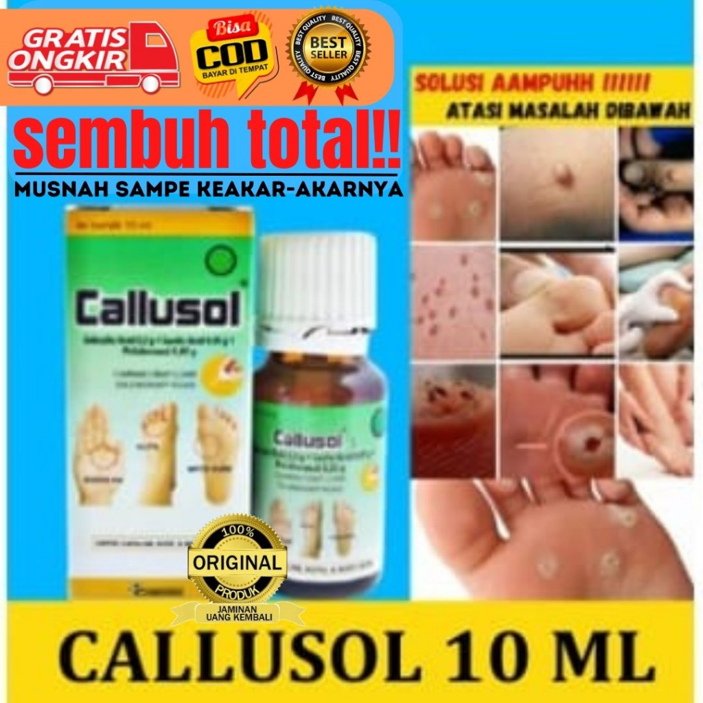 Jual Obat Mata Ikan Kutil Kapalan Kaki Pecah Pecah CALLUSOL Terbukti ...
