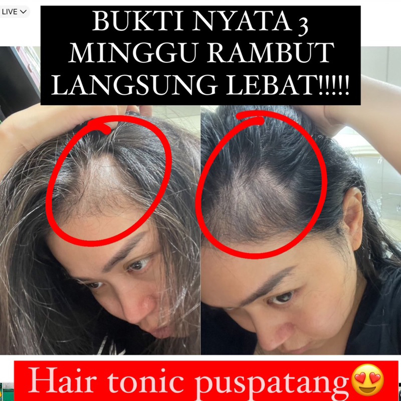 Jual 2 BOX HAIRTONICPUSPATANG SOLUSI RAMBUT RONTOK BOTAK TIPIS KETOMBE | Shopee Indonesia