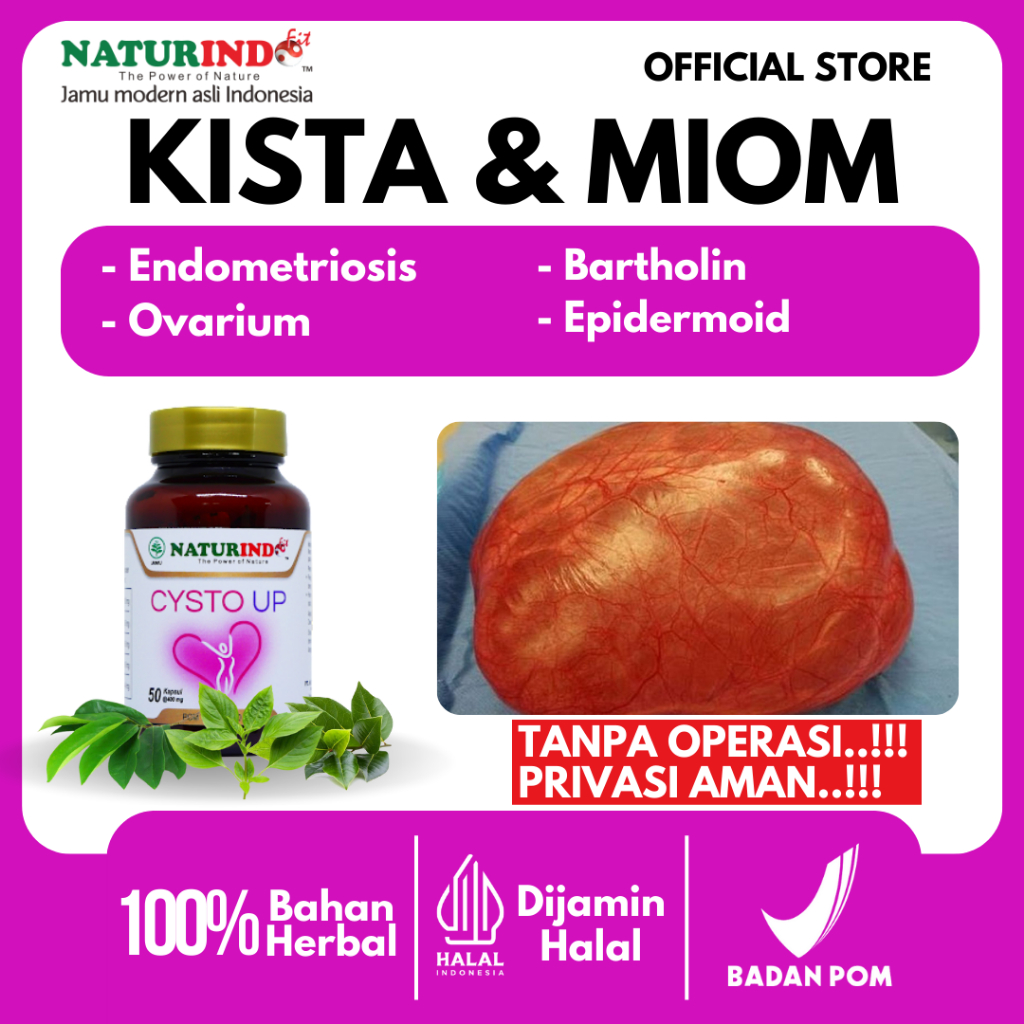 Jual Obat Kista Miom Bartholin Ovarium Kista Endometriosis Herbal Ampuh ...