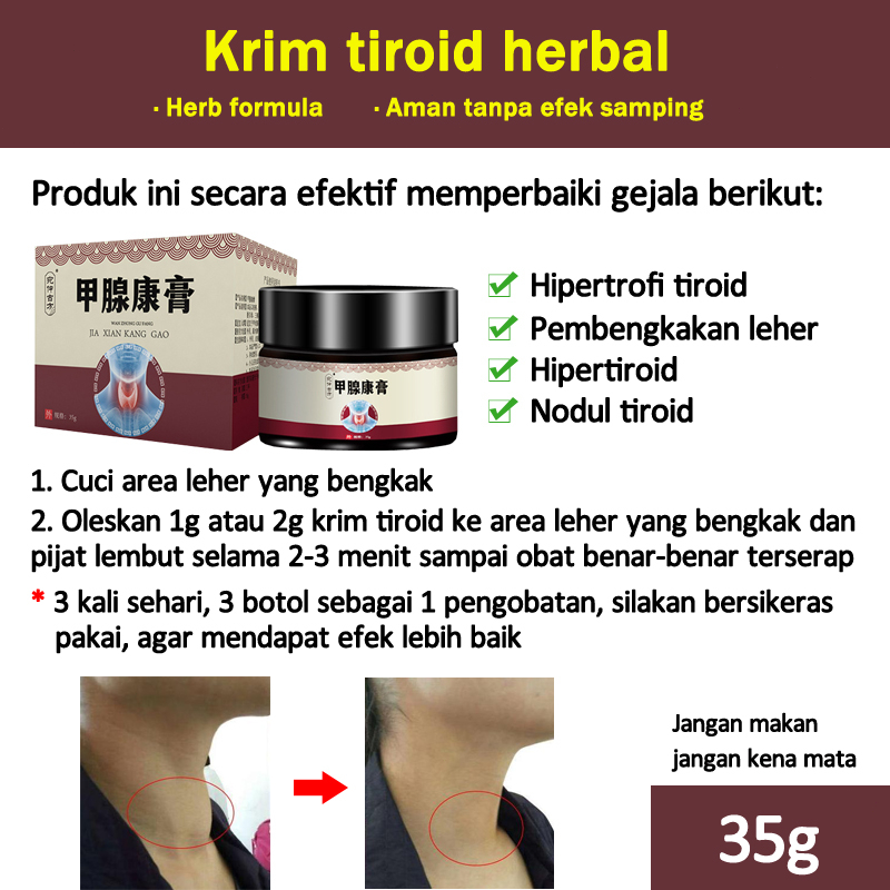 Jual Obat Gondok Kelenjar Tiroid Hipertiroid Hipotiroid Gondok Beracun ...