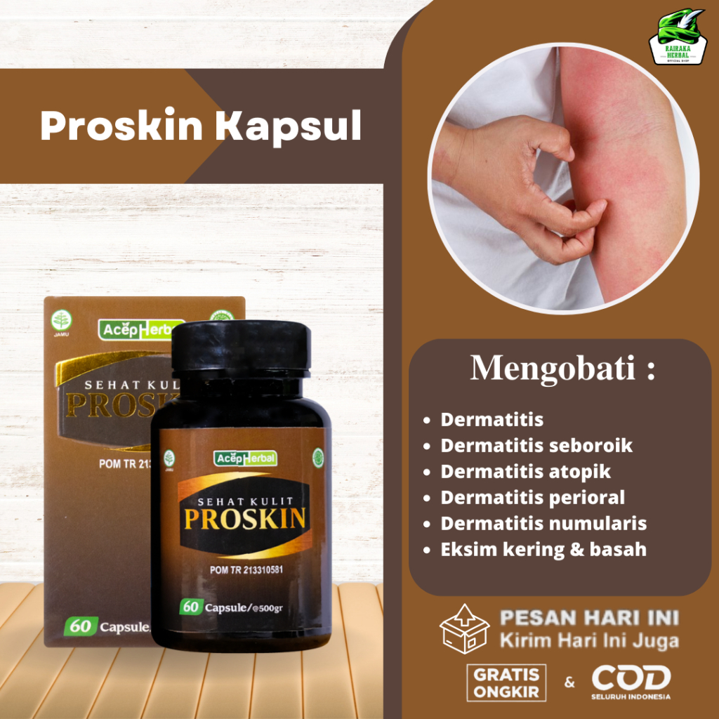 Jual PROSKIN Obat Herbal Dermatitis, Obat Dermatitis Atopik, Obat ...
