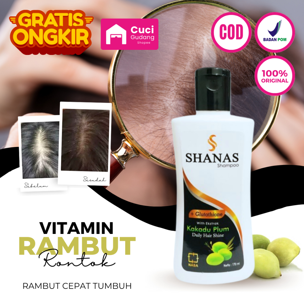 Jual Shampo Untuk Rambut Rontok Parah - Shampoo Pemanjang Rambut ...