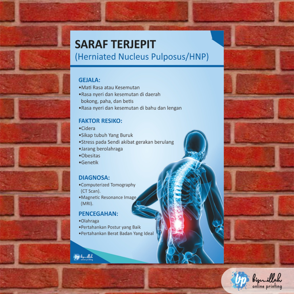 Jual Poster Kesehatan Saraf terjepit | Shopee Indonesia