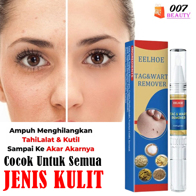 Jual SUMIFUN EELHOE Tag & Wart Remover - Obat Penghilang Tahi Lalat dan ...