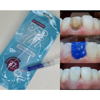 Jual AFHAM DENTAL ETCHING GEL GIGI DSP ETCH REGISTRASI AKL / ETSA ETCHA ...