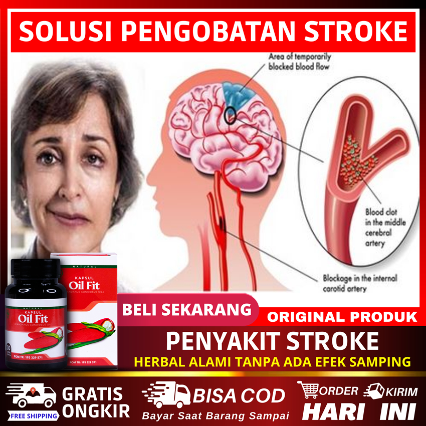 Jual Obat Stroke Ringan Sebelah kanan / Kiri Bell Palsy Mulut Kaku ...