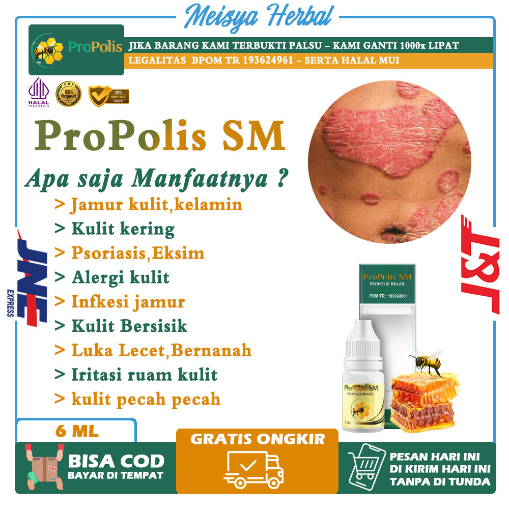 Jual Obat Jamur Kulit Gatal Gatal Alergi Kurap Selangkangan Infeksi ...