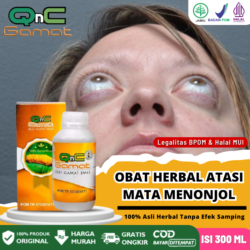 Jual Obat Tradisional Mata Menonjol Akibat Penyakit Tiroid, Obat Mata ...