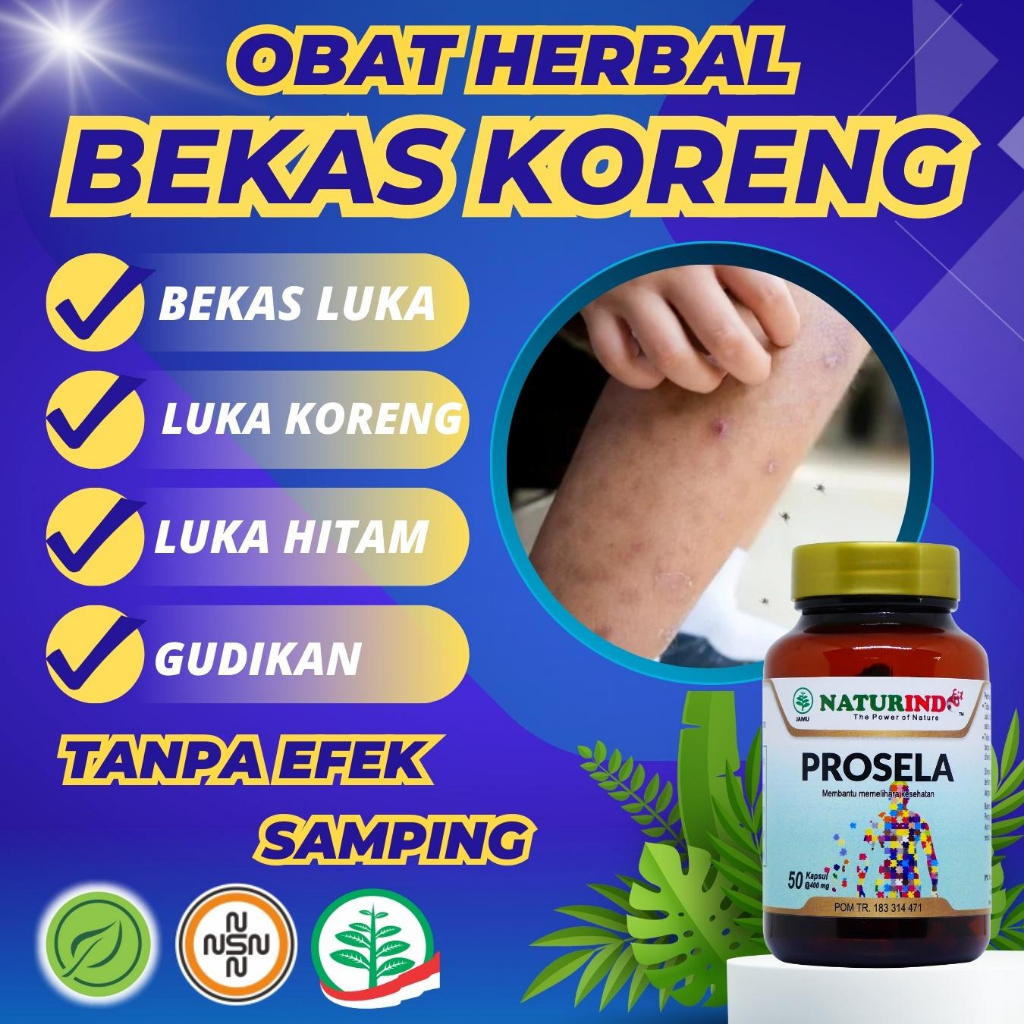 Jual Obat Penghilang Bekas Luka Hitam Koreng di Kaki Kulit Gatal ...