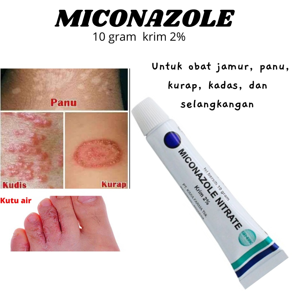 Jual Miconazole Nitrate 2% Cream Krim Salep Gatal Anti Jamur ...