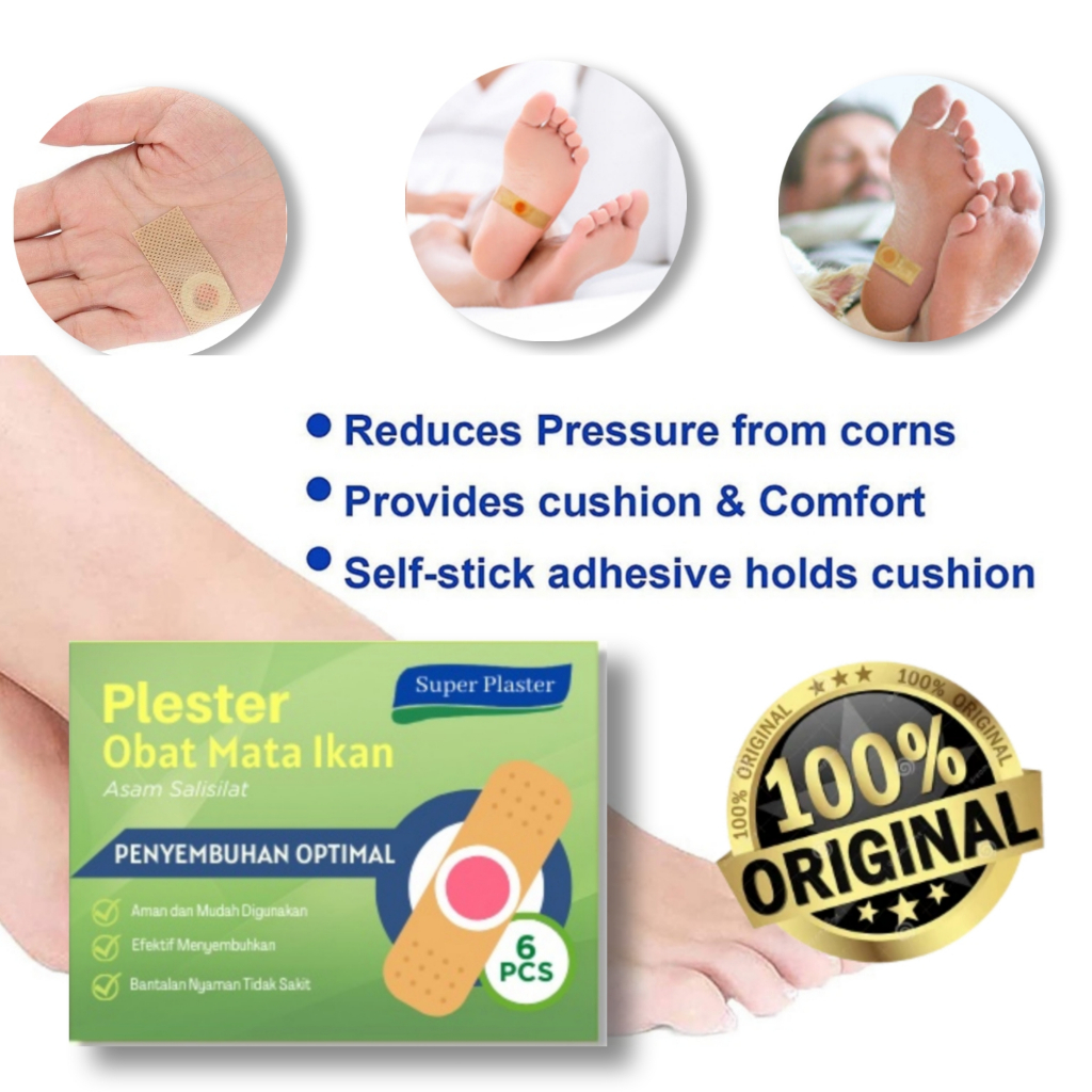Jual Plaster Obat MATA IKAN & KUTIL / Callus Remover | Shopee Indonesia