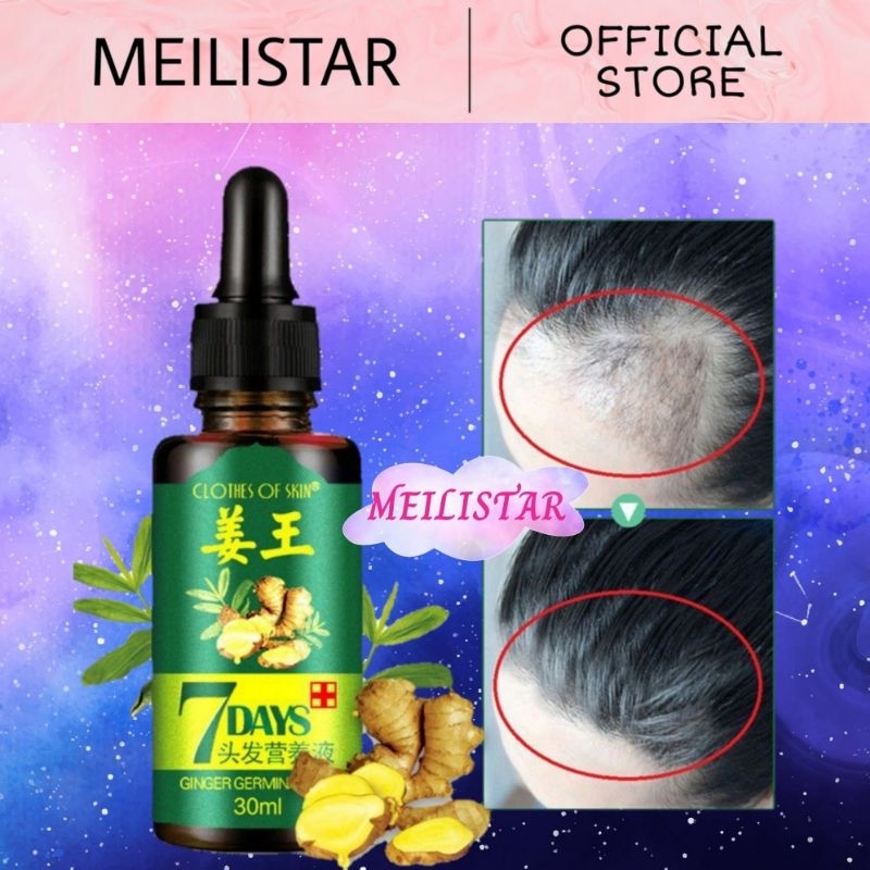 Jual Cairan Essence Obat Penumbuh Rambut King of Ginger Germinal ...
