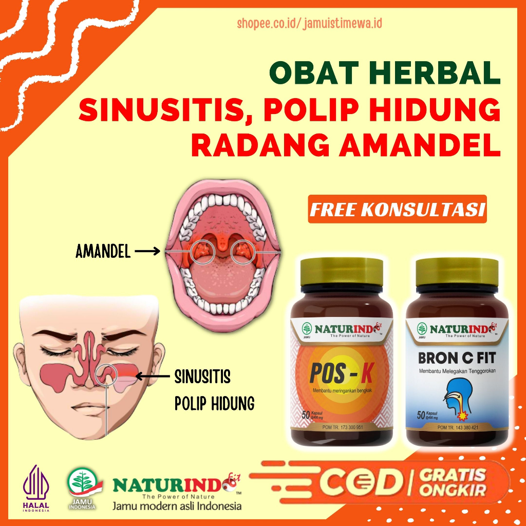 Jual Obat Sinusitis Polip Hidung Amandel Menahun Paling Ampuh Herbal ...