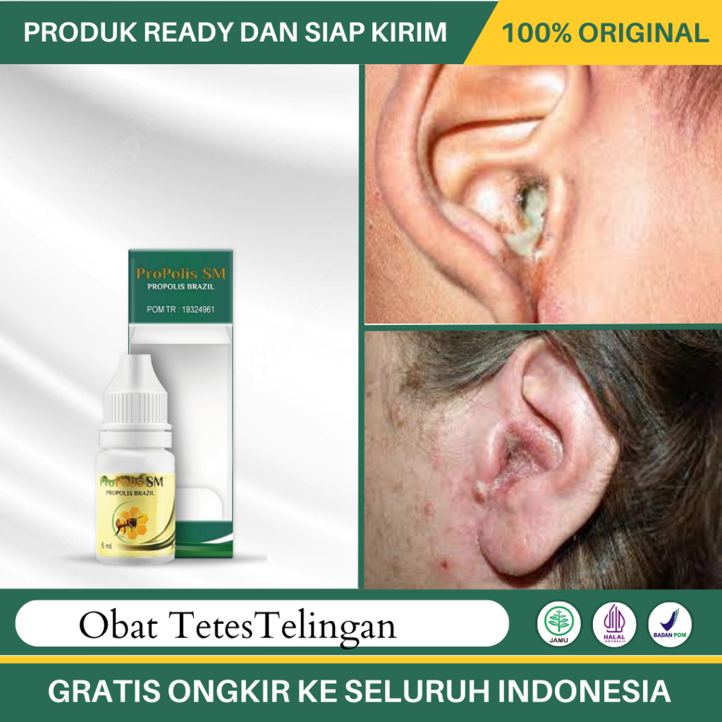 Jual Obat Tetes Telinga Berair, Obat Bau Busuk, Obat Congek, Obat ... Jual Obat Tetes Telinga Berair, Obat Bau Busuk, Obat Congek, Obat ...