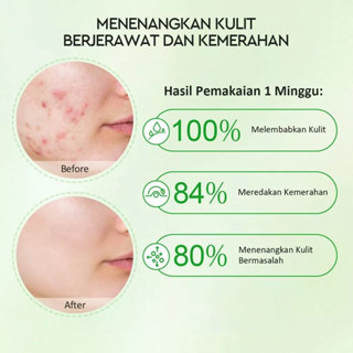 Jual GLAD2GLOW - G2G Centella Allantoin Soothing Moisturizer Gel Repair ...