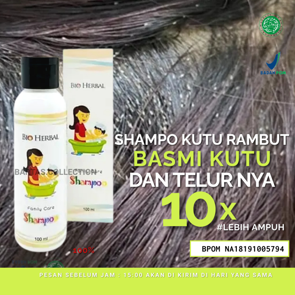 Jual SAMPO SHAMPO ANTI KUTU ANAK & DEWASA AMPUH PEMBASMI KUTU RAMBUT ...