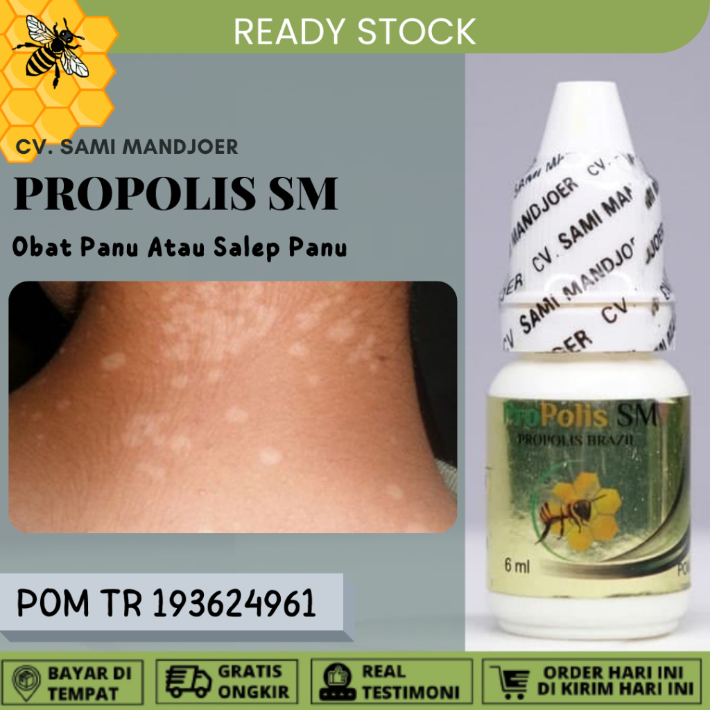 Jual Obat Panu Anak Dan Dewasa Obat Kulit Jamur Panu Hapuran Balas Bogo ...