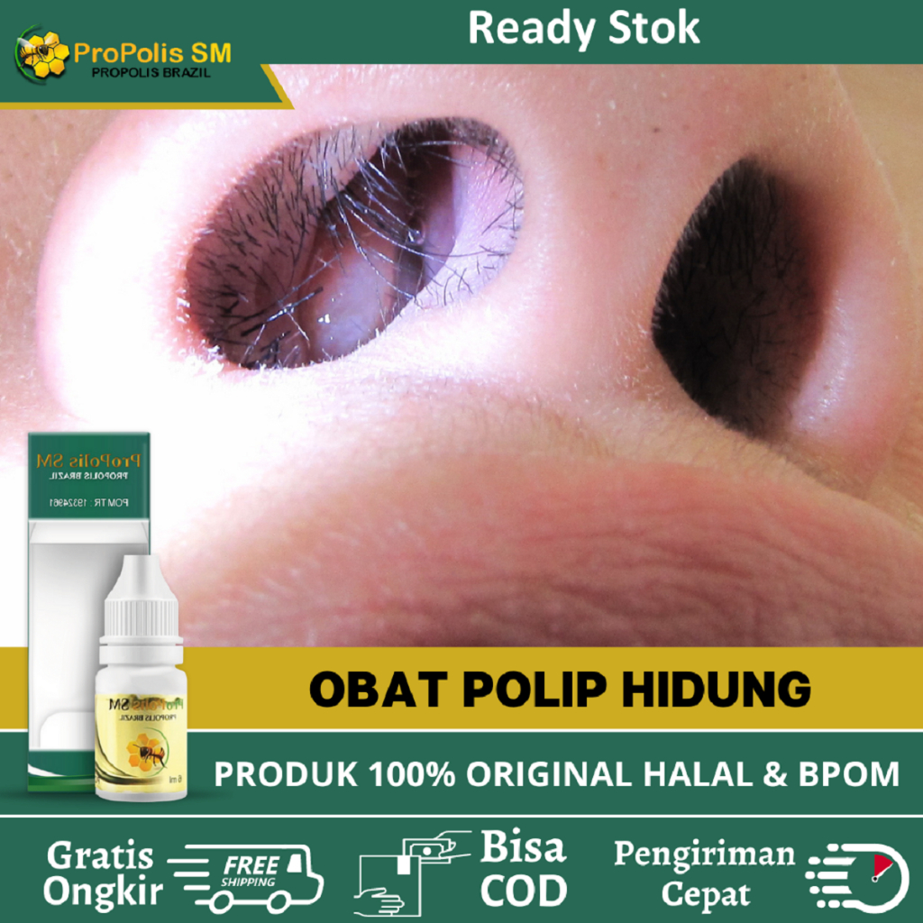Jual Obat Tetes Polip Hidung, Perontok Benjolan Di Dalam Hidung, Obat ...