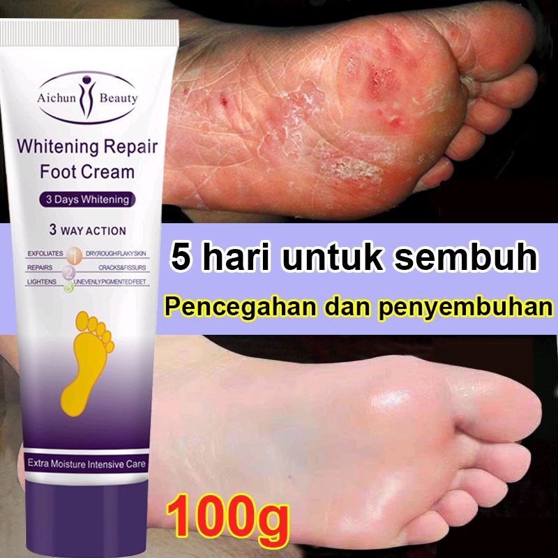 Jual original Foot cream 100g obat kaki pecah krim tumit pecah dan ...