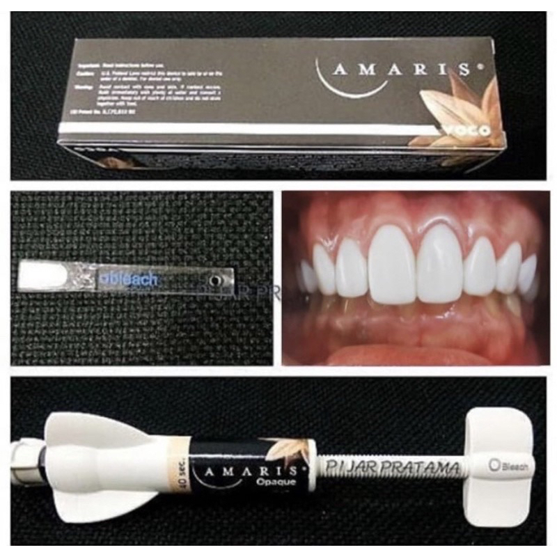 Jual DENTAL COMPOSITE AMARIS VOCO GERMANY / KOMPOSIT ANTERIOR DIRECT ...