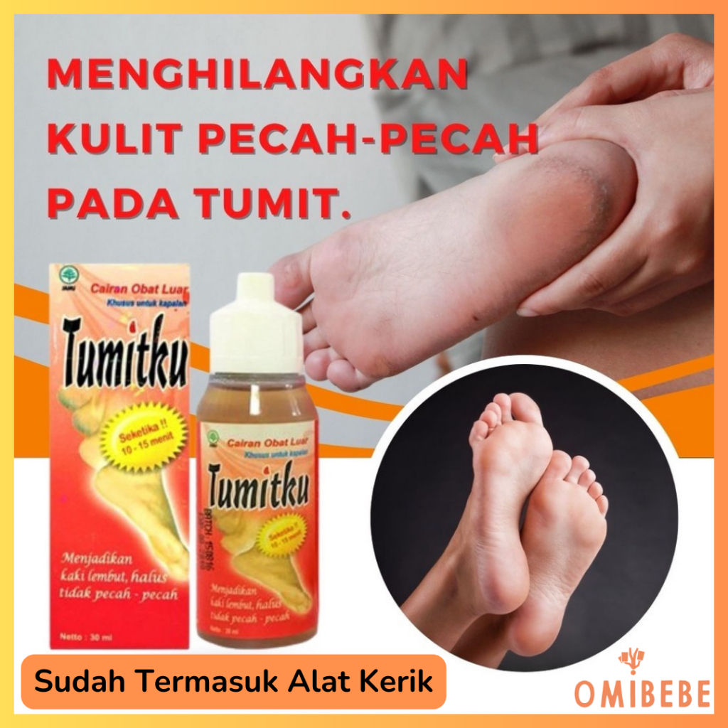 Jual Tumitku Obat Kaki Pecah Original BPOM Obat Kaki Kering Dan Pecah ...