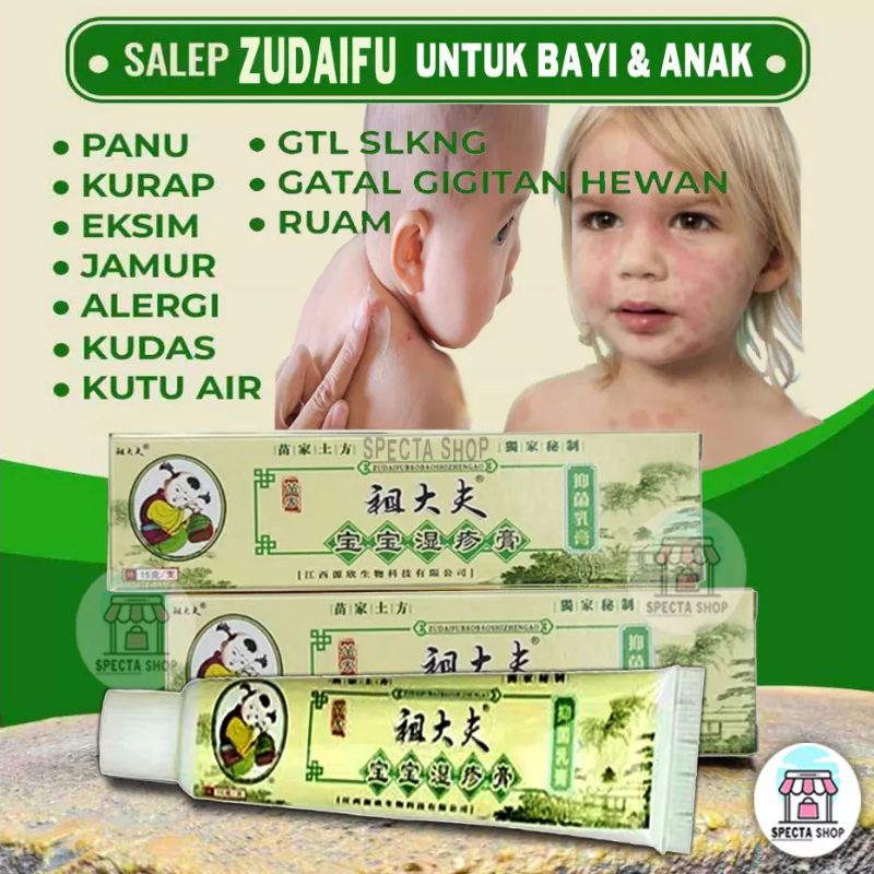 Jual Salep Zudaifu Bayi & Anak Obat Gatal Balita Alergi Jamur Panu ...