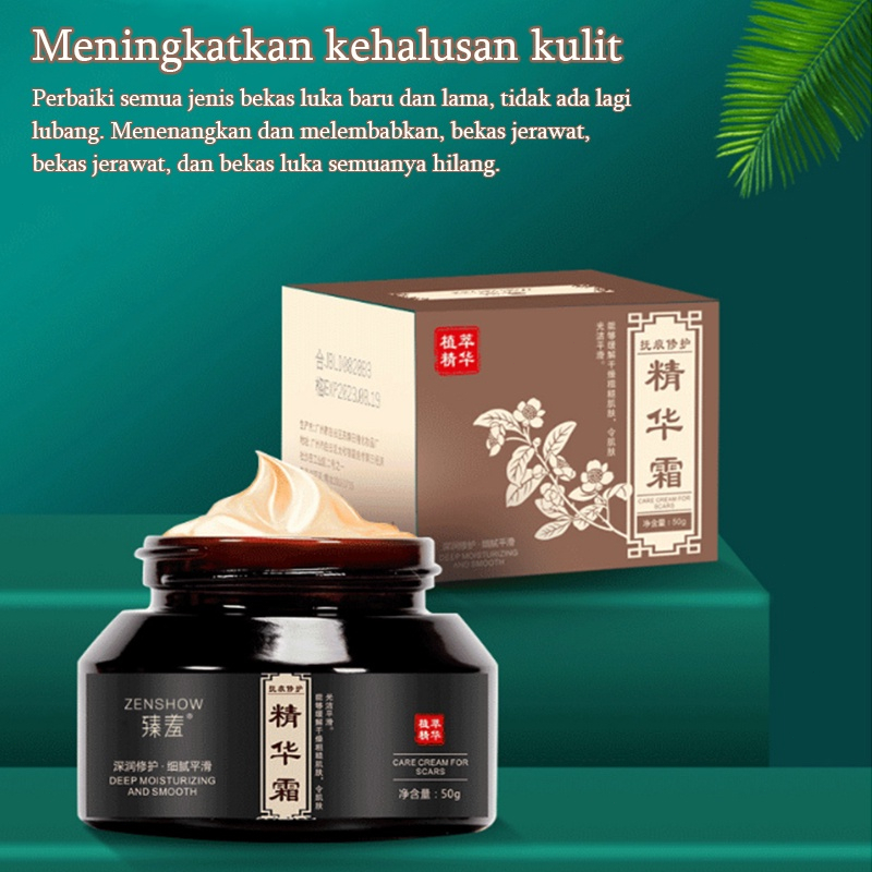 Jual CREAM PENGHILANG STRETCH MARK Krim Penghilang Bekas Luka 60G ...