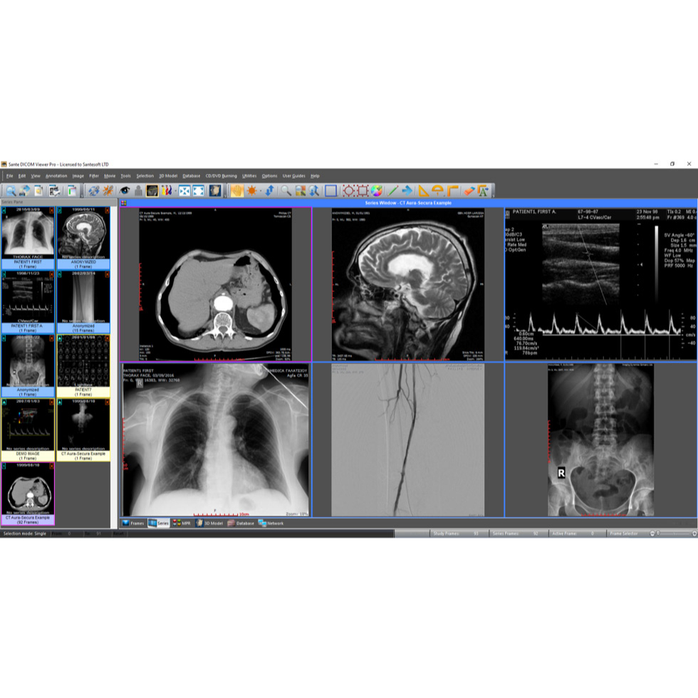 Jual Sante Dicom Viewer 3D Pro2023 | Shopee Indonesia