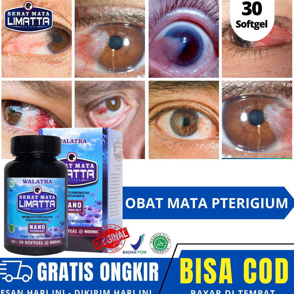 Jual Obat Khusus Mata Pterygium Mata Berlemak Mata Glaukoma Selaput Mata Menebal Herbal Sehat ...