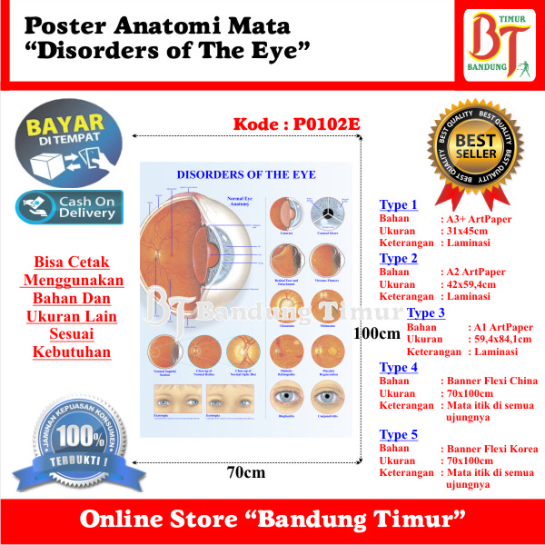 Jual POSTER ANATOMI MATA - DISORDERS OF THE EYE | Shopee Indonesia