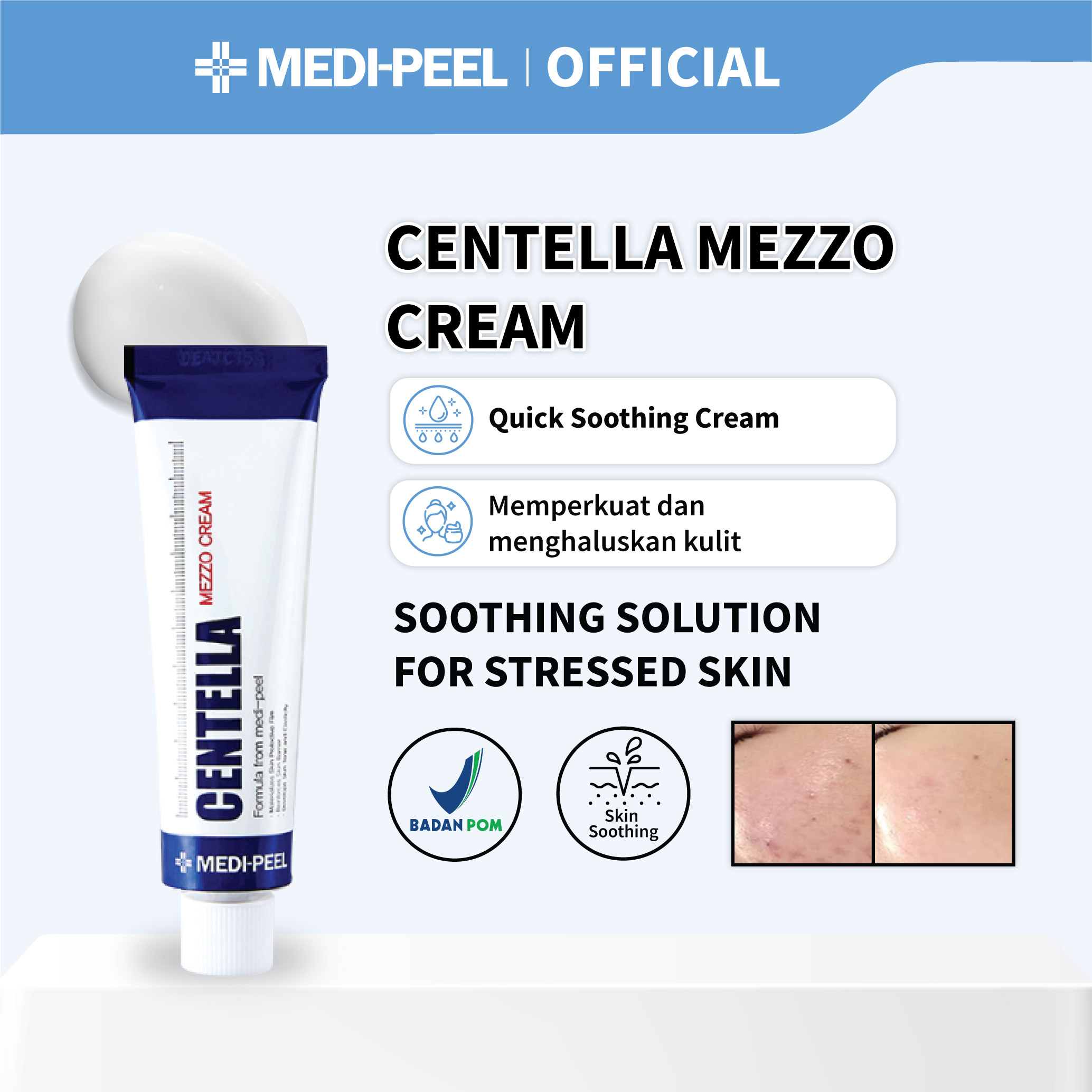 Jual MEDI-PEEL - Centella Mezzo Cream - 30 ml | Shopee Indonesia